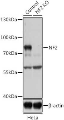 NF2/Merlin Antibody (NBP3-03740): Novus Biologicals