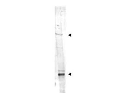 NIPBL Antibody (NBP1-77974): Novus Biologicals