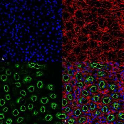 NKCC2/SLC12A1 Antibody (NBP1-44269): Novus Biologicals