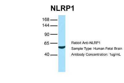 NLRP1/NALP1 Antibody (NBP1-54899): Novus Biologicals