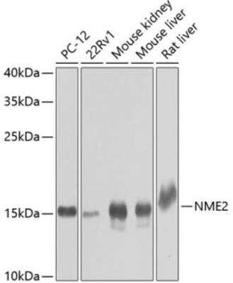 NM23-H2/NME2 Antibody (NBP3-05624): Novus Biologicals