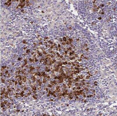 NRAMP1/SLC11A1 Antibody (NBP1-87809): Novus Biologicals