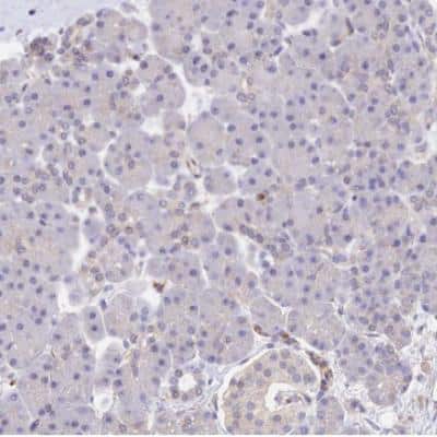 NRAMP1/SLC11A1 Antibody (NBP1-87809): Novus Biologicals