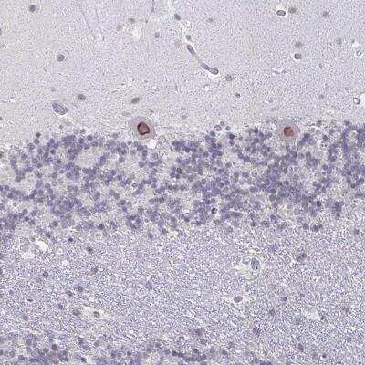 NUP133 Antibody (NBP2-31795): Novus Biologicals