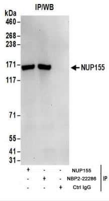 NUP155 Antibody (NBP2-22286): Novus Biologicals