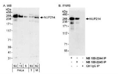 NUP214 Antibodies: Novus Biologicals
