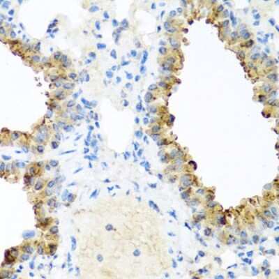 Ninein Antibody (NBP2-93990): Novus Biologicals