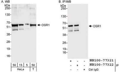 OXSR1 Antibody (NB100-77322): Novus Biologicals