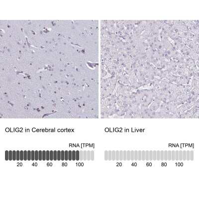 Olig2 Antibodies: Novus Biologicals