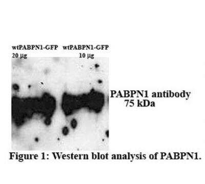 PABPN1 Antibody (NBP1-57216): Novus Biologicals