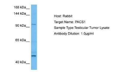 PACS1 Antibody (NBP2-85434): Novus Biologicals