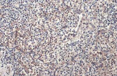 PARP14 Antibody (NBP3-13051): Novus Biologicals