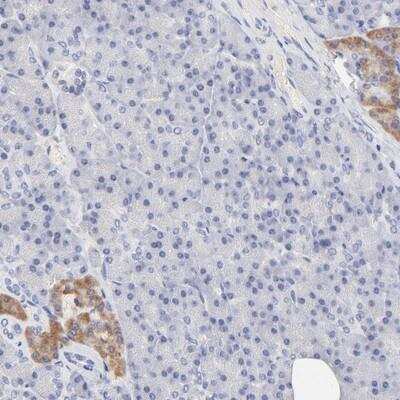 PEO1 Antibody (NBP1-90814): Novus Biologicals
