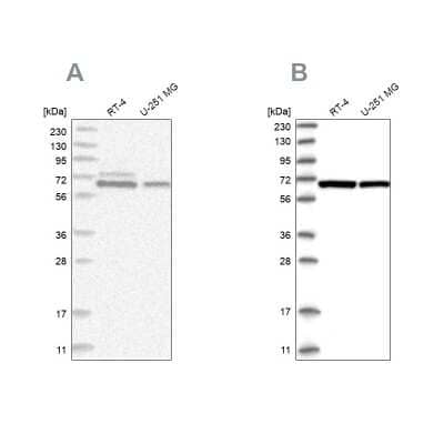 PGM3 Antibody (NBP1-89208): Novus Biologicals