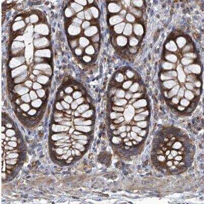 PIGH Antibody (NBP1-83342): Novus Biologicals