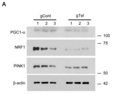 PINK1 Antibodies: Novus Biologicals