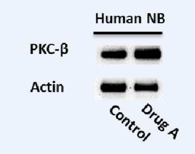 PKC beta Antibody (NBP2-19846): Novus Biologicals