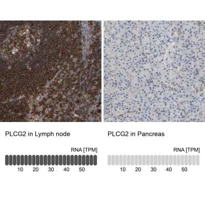 PLC-gamma 2 Antibody (NBP1-86030): Novus Biologicals