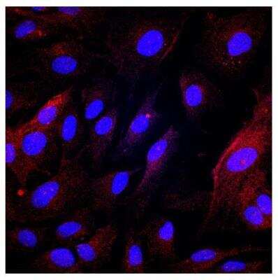 PLVAP Antibody (NBP2-19868): Novus Biologicals