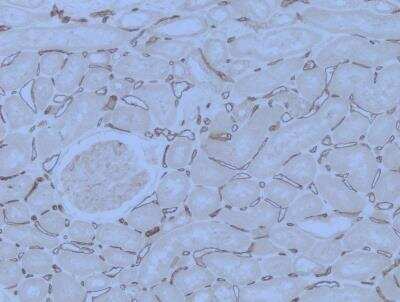 PLVAP Antibody (NBP1-83911): Novus Biologicals