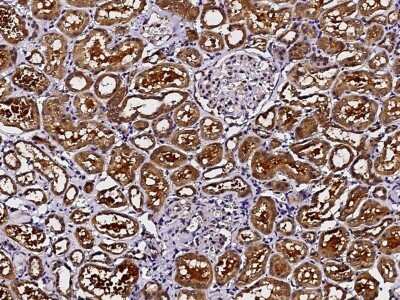 PMVK/phosphomevalonate kinase Antibody (NBP3-00339): Novus Biologicals