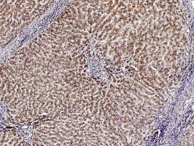 PMVK/phosphomevalonate kinase Antibody (NBP3-00339): Novus Biologicals