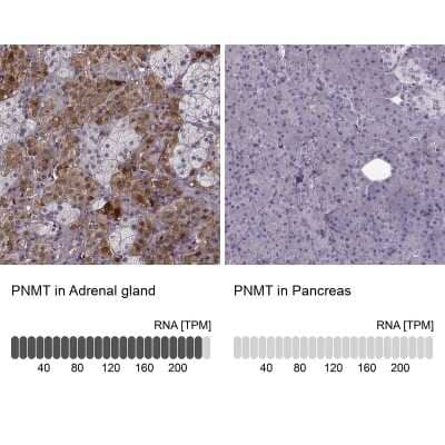 PNMT Antibody (NBP2-33602): Novus Biologicals