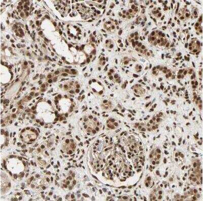PNPLA6 Antibody (NBP1-80984): Novus Biologicals