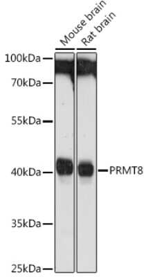 PRMT8 Antibody (NBP3-15568): Novus Biologicals
