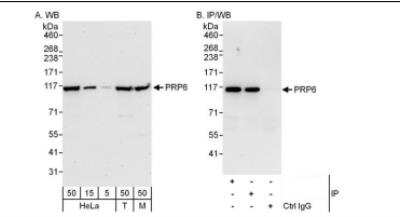 PRPF6 Antibodies: Novus Biologicals