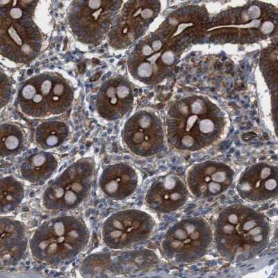 PTGER4/EP4 Antibody (NBP1-84833): Novus Biologicals