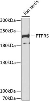 PTP sigma/PTPRS Antibody (NBP2-92999): Novus Biologicals