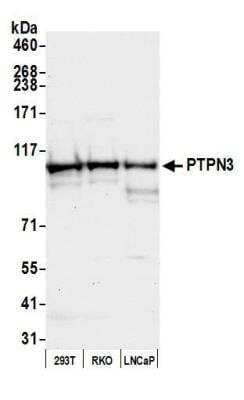 PTPN3 Antibody (NBP2-78797): Novus Biologicals