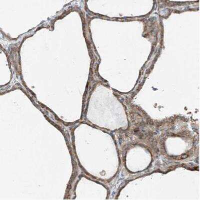 PUM2 Antibody (NBP1-89623): Novus Biologicals