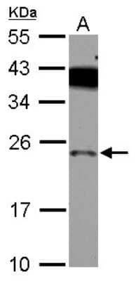 PX19 Antibody (NBP2-20015): Novus Biologicals
