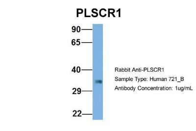 Phospholipid Scramblase 1/PLSCR1 Antibody (NBP1-57816): Novus Biologicals