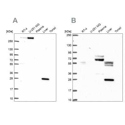 QDPR Antibody (NBP2-49455): Novus Biologicals