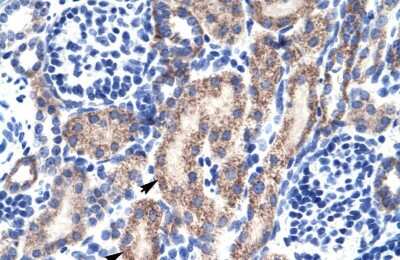 RB associated KRAB repressor Antibody (NBP2-85608): Novus Biologicals
