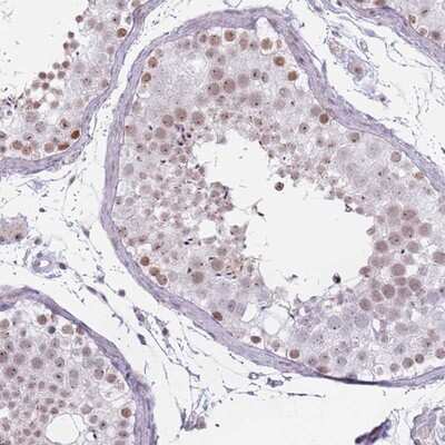REXO4 Antibody (NBP2-13221): Novus Biologicals
