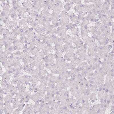 RFX2 Antibody (NBP2-13224): Novus Biologicals