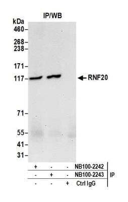 RNF20 Antibody (NB100-2243): Novus Biologicals