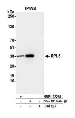 RPL5 Antibody (NBP2-22285): Novus Biologicals