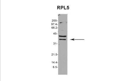 RPL5 Antibody (NBP1-57126): Novus Biologicals