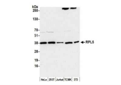 RPL5 Antibody (NBP2-22285): Novus Biologicals