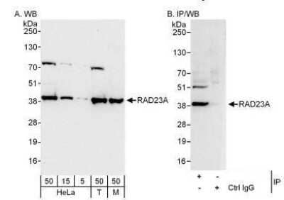 Rad23 Antibody (NBP1-49977): Novus Biologicals