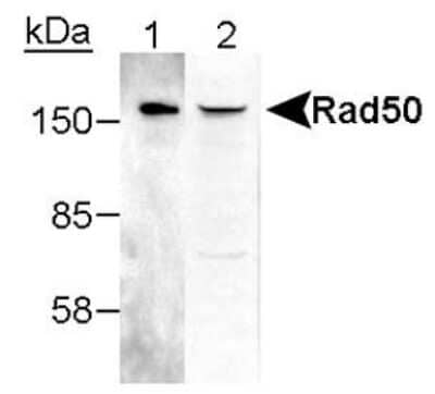 Rad50 Antibody (NB100-1487): Novus Biologicals