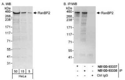 RanBP2 Antibody (NB100-93338): Novus Biologicals