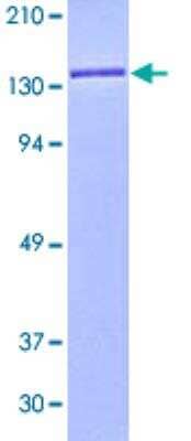 Recombinant Human PKC mu GST Protein (P4228): Novus Biologicals