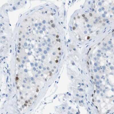 SALL4 Antibody (NBP1-85206): Novus Biologicals