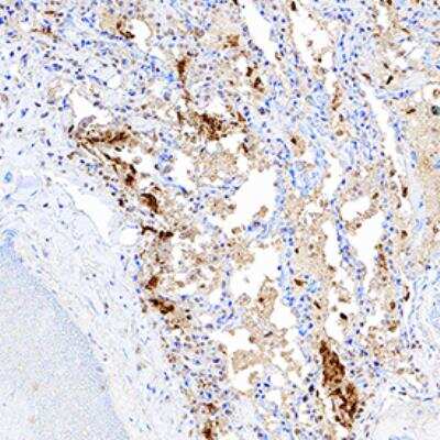 SARS Nucleocapsid Protein Antibody Pack (NBP3-05695): Novus Biologicals